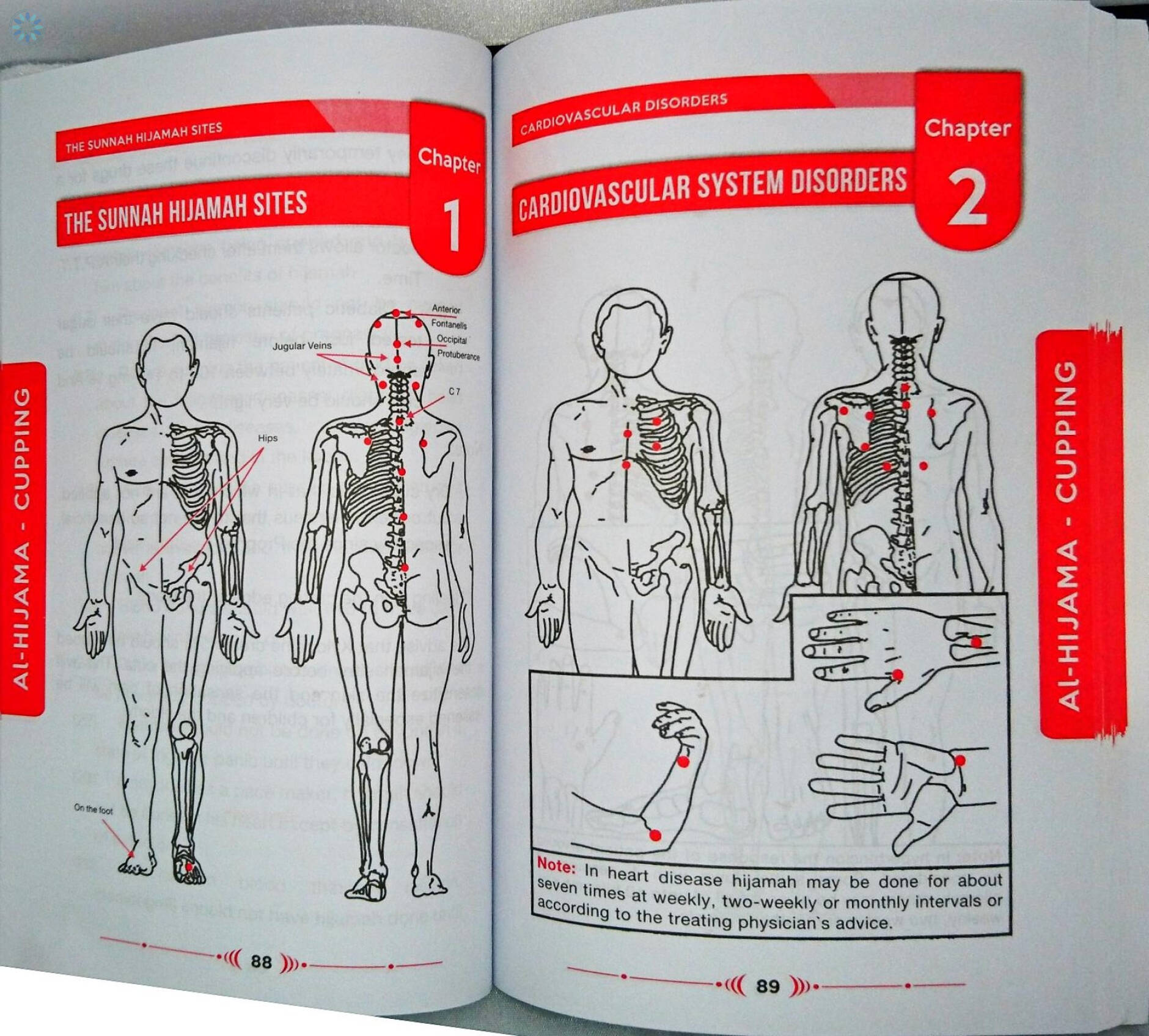 Books › Medicine & Dreams › Al Hijama Cupping - Healing the Sunnah Way